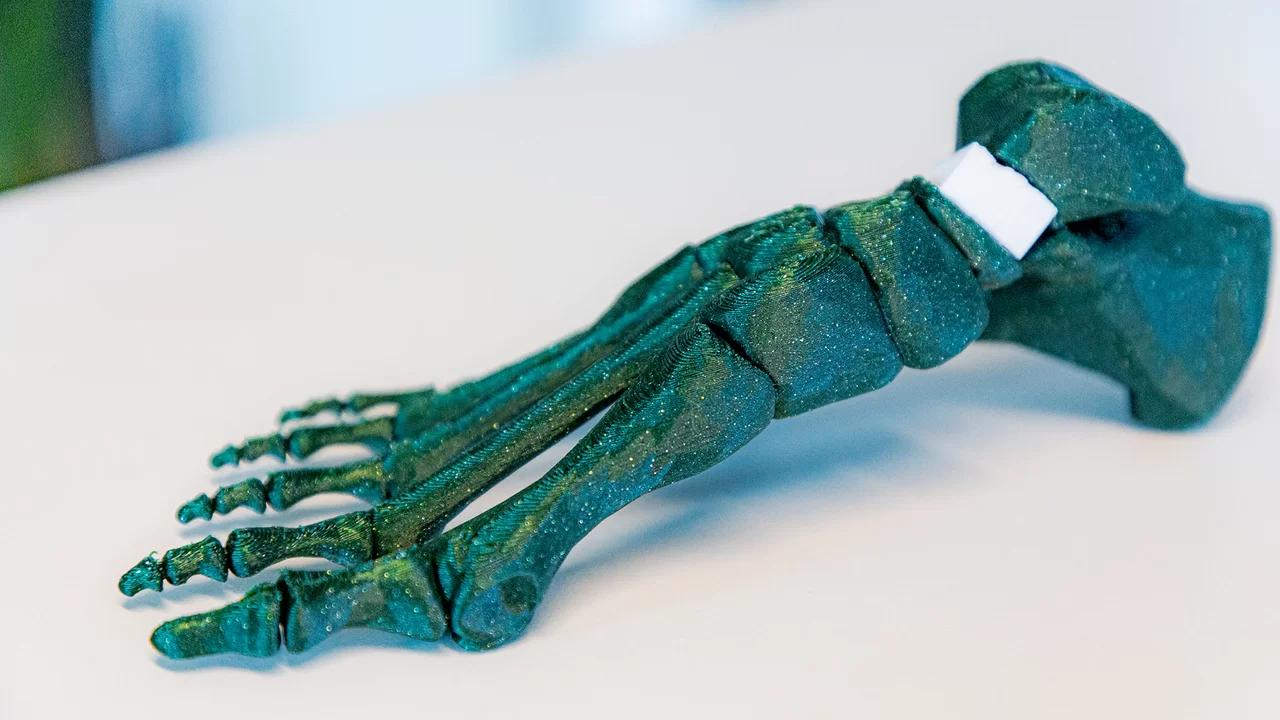 Natural Bone Replacements from a 3D Printer